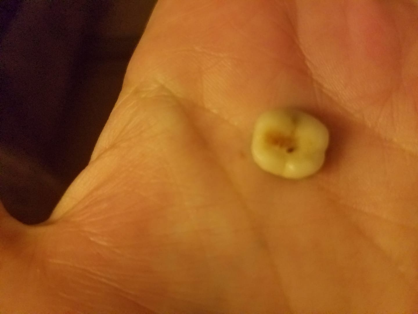 Mystery of the Missing Molar | Furwood Forest